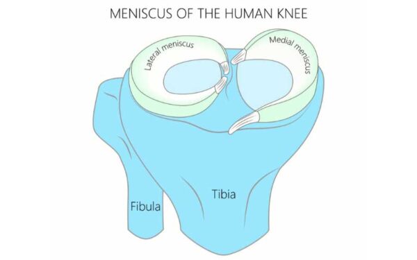 Meniscus Injuries | Medial Meniscus Tear | Meniscus Tear Types ...