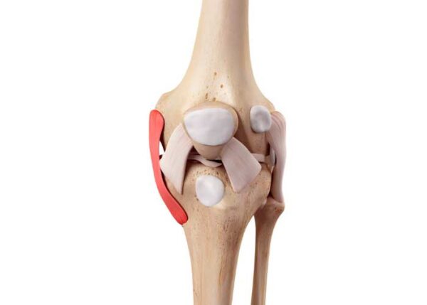 Medial Collateral ligament (MCL) Reconstruction | Repair | Orthopedic ...