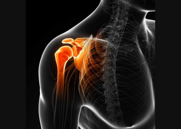 Rotator Cuff Injury | Rotator Cuff Tear | Rotator Cuff Tendinitis ...